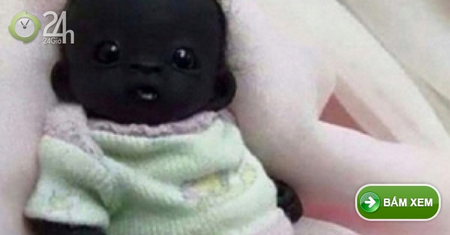 Dân mạng tranh cãi nảy lửa về "em bé đen nhất thế giới"