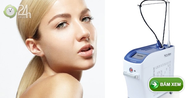 Laser Alexandrite Noblex – đột phá mới trong điều trị nám da